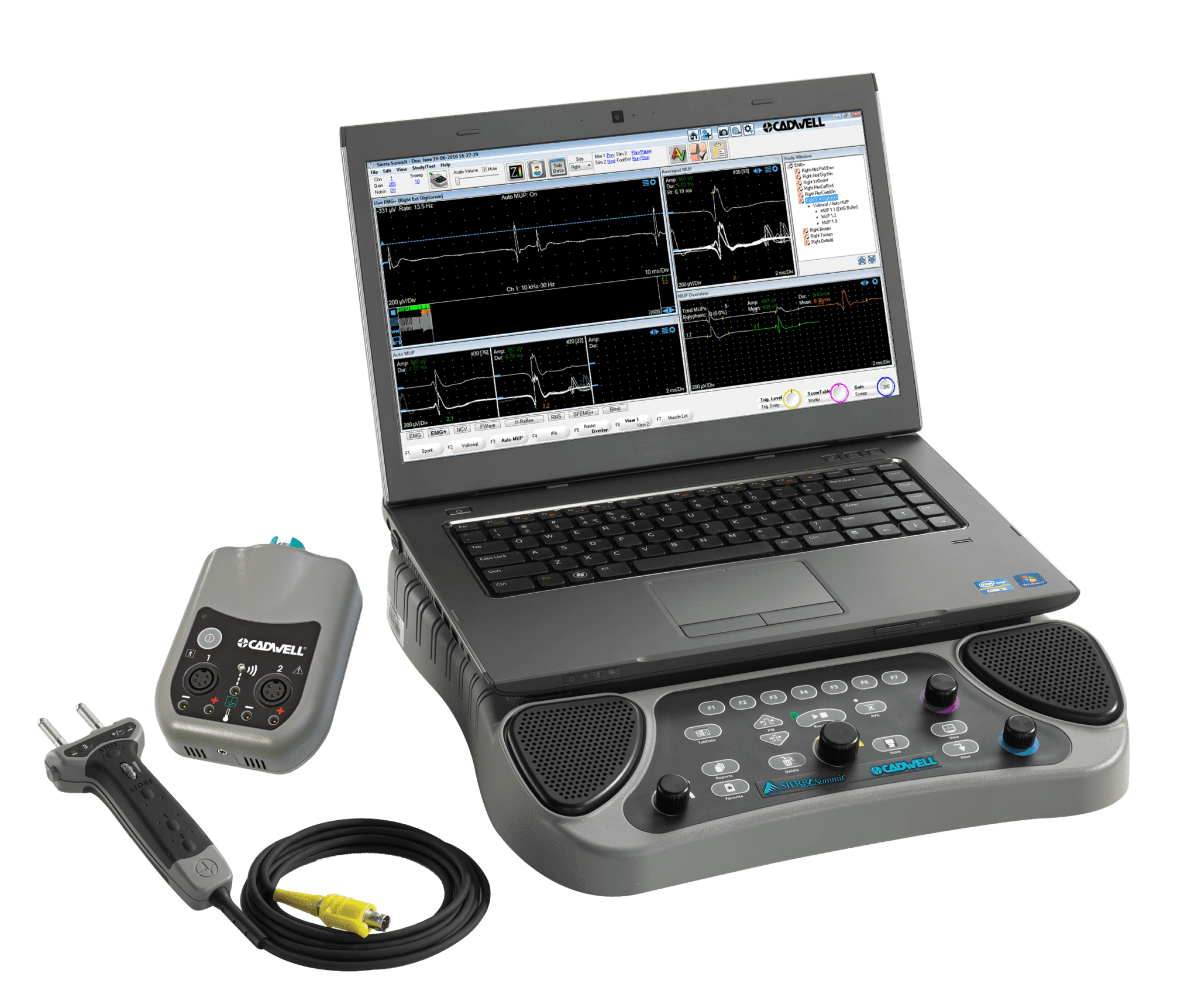 Electromyography (EMG) | Summit EMG Machine with EP & Ultrasound