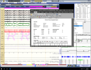 Easy III PSG Software for PSG and HSAT Sleep Studies