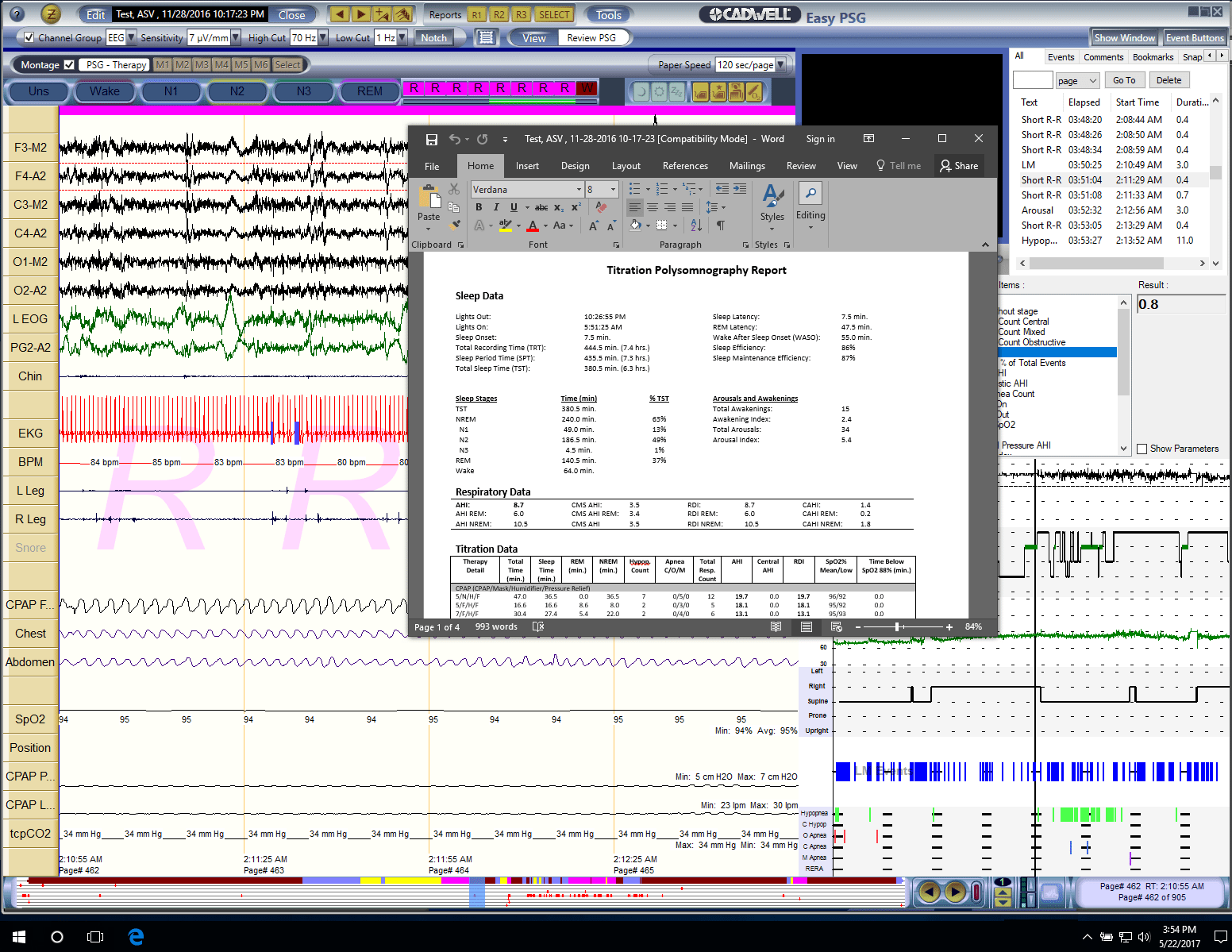 Easy III PSG Software for PSG and HSAT Sleep Studies