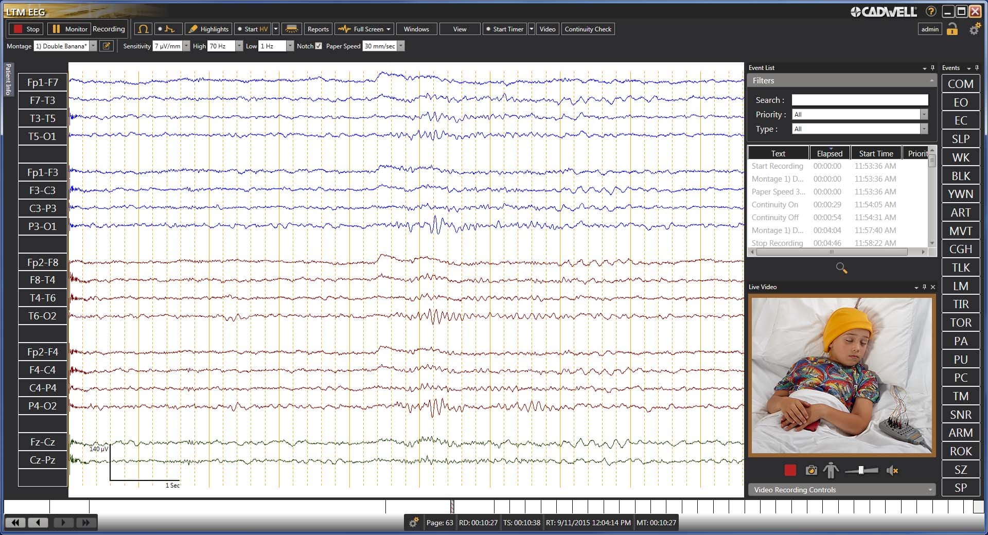 Arc Essentia EEG | Cadwell Electrodiagnostic (EDX), LTM, ICU, ER