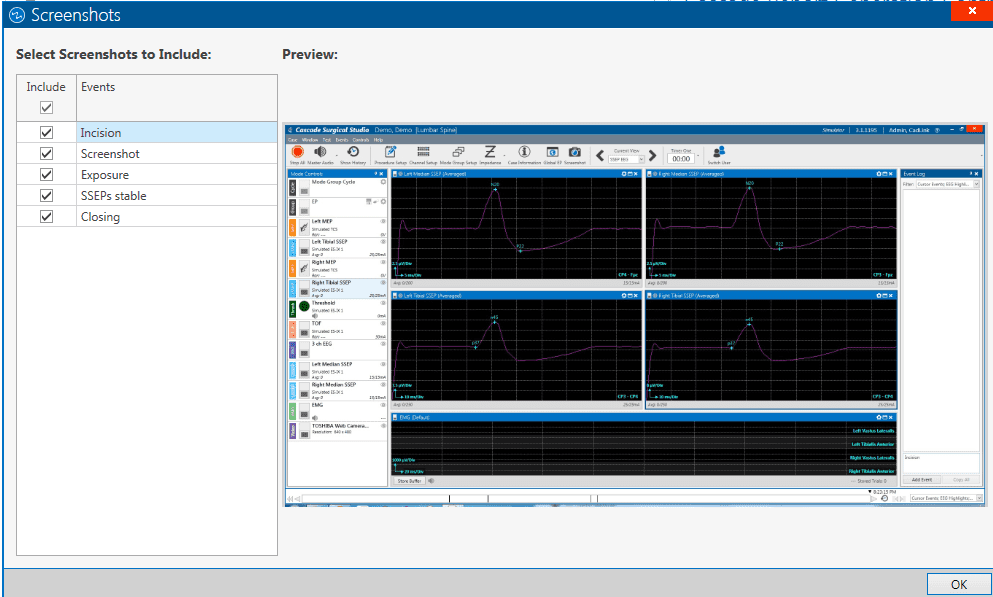 Cascade PRO IONM | Cadwell Intraoperative Neuromonitoring Equipment