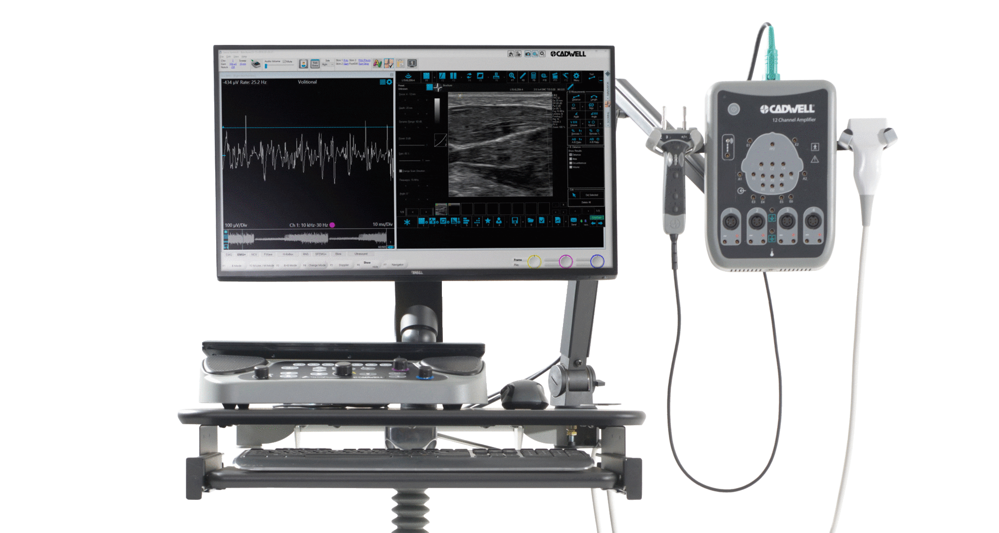 Electromyography (EMG) | Summit EMG Machine with EP & Ultrasound Electromyography (EMG) | Summit EMG Machine with EP & Ultrasound