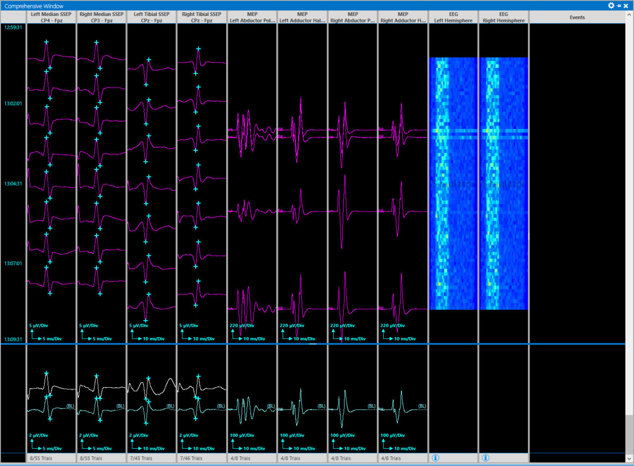 Cascade Surgical Studio IONM Software | Cadwell Industries, Inc.