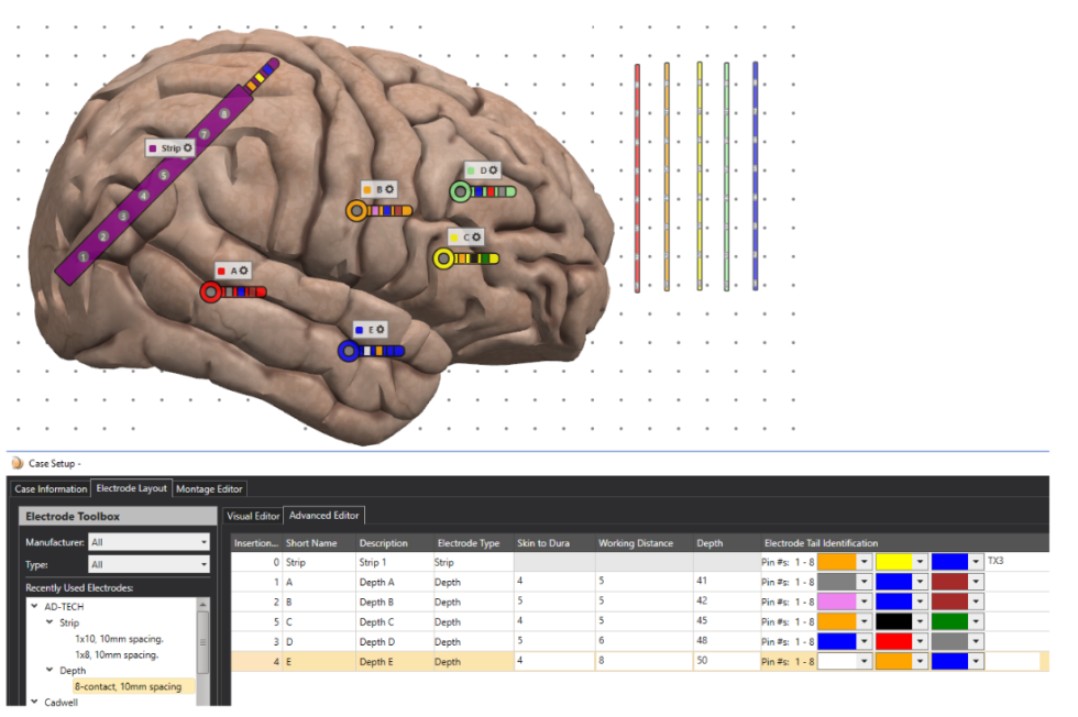 Cadwell Zenith 144-288ch High Ch Count EEG & Direct Cortical Stim