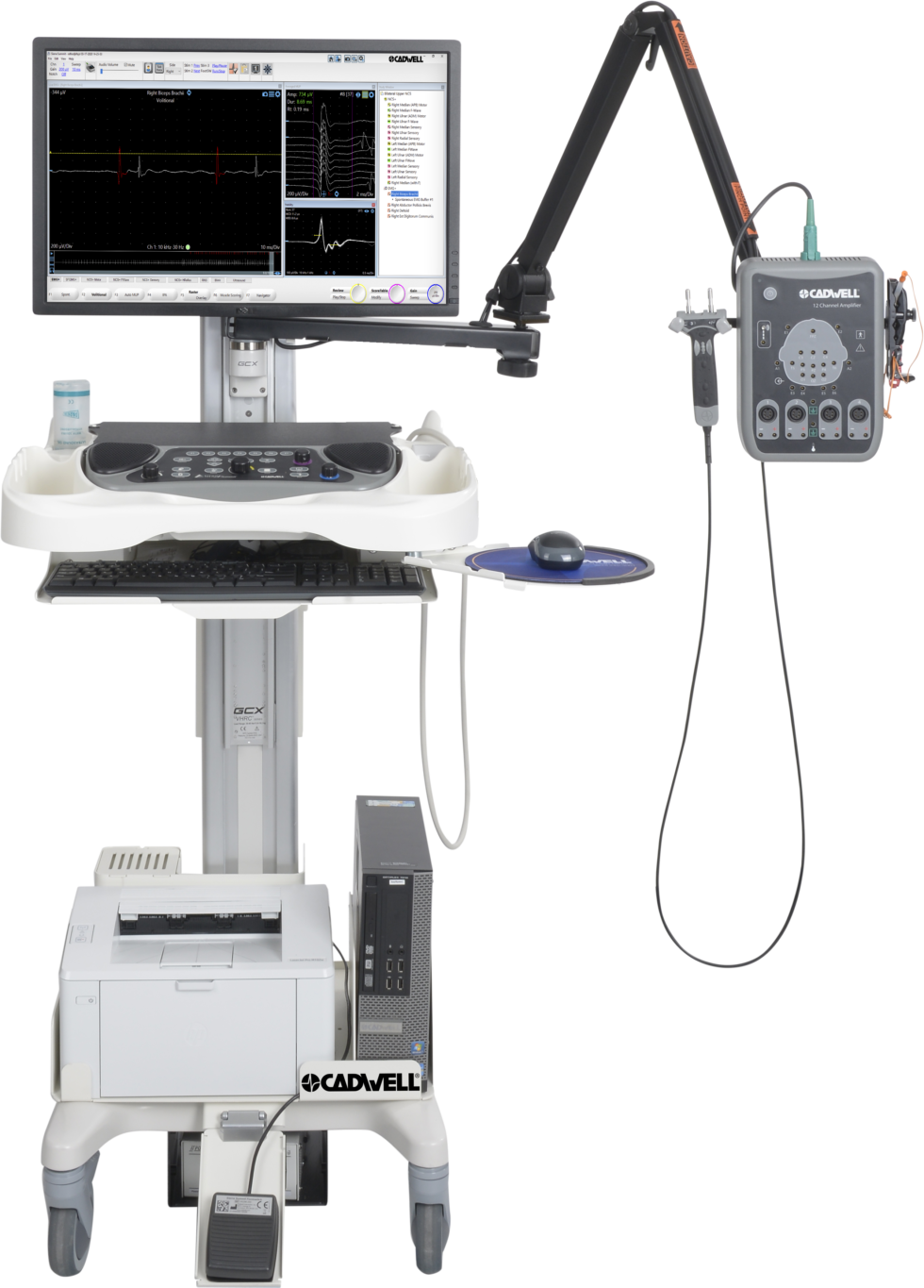 Sierra Summit EDX for EMG NCS EP and Integrated Ultrasound