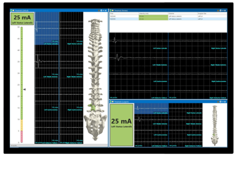 Intraoperative Neuromonitoring IONM IOM NIOM - Cadwell Cascade