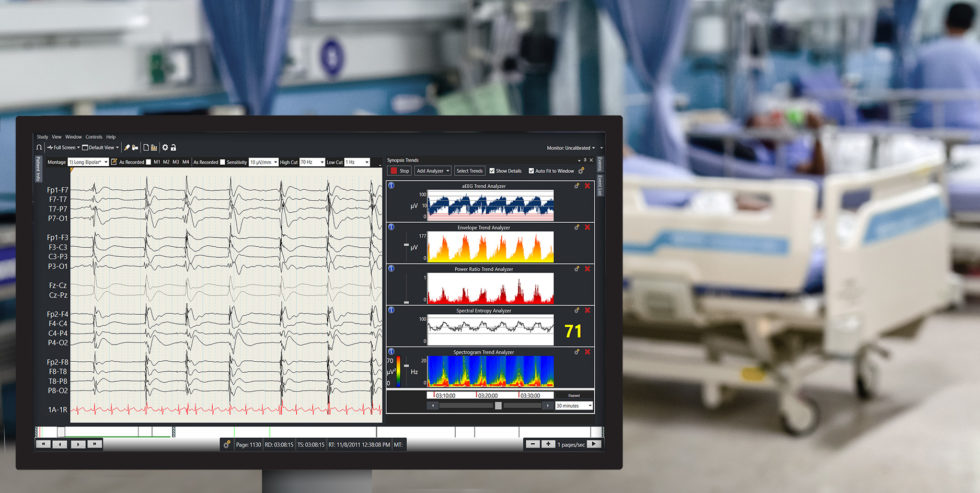 Epilepsy Monitoring from Diagnosis to Treatment | Cadwell EEG