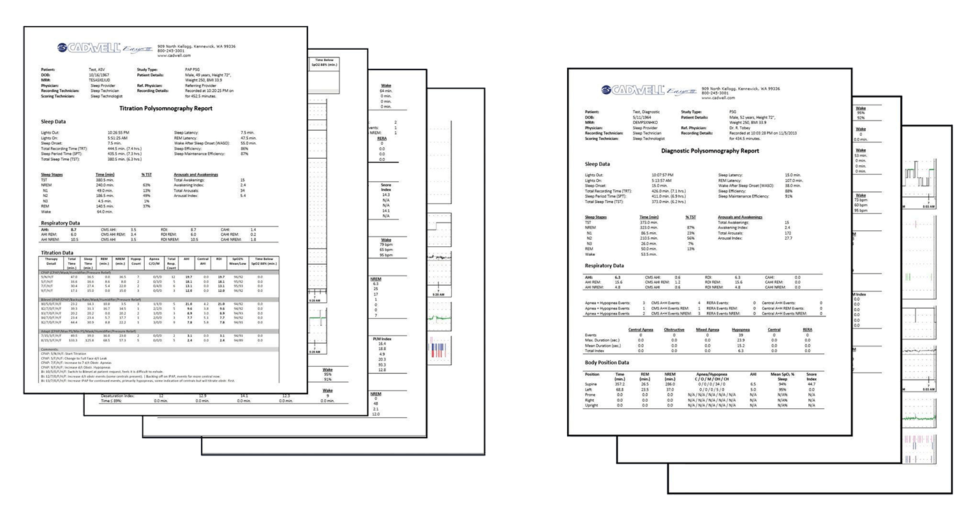 Easy III PSG Software for PSG and HSAT Sleep Studies