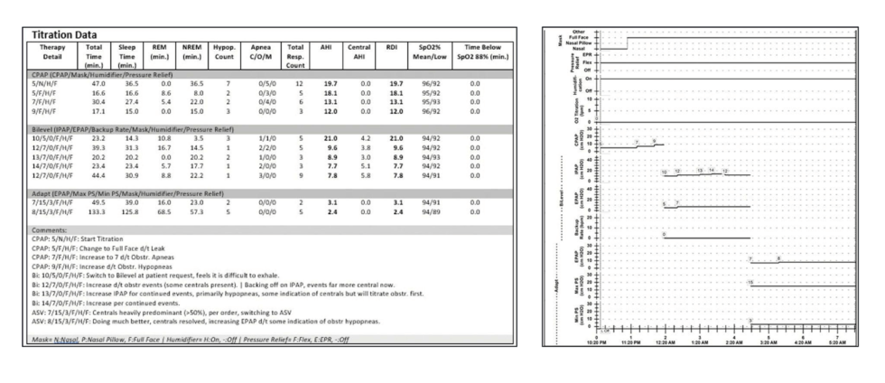 Easy III PSG Software for PSG and HSAT Sleep Studies