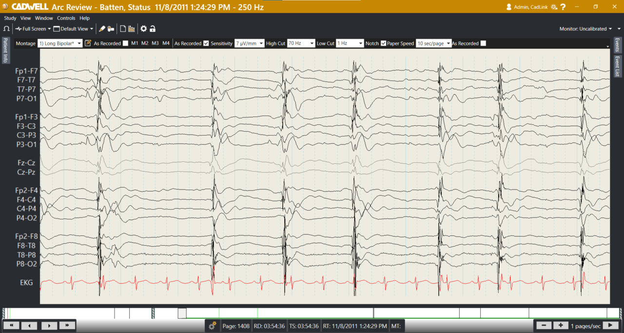 Arc EEG Software for at-home and in-hospital EEG, LTM, EMU