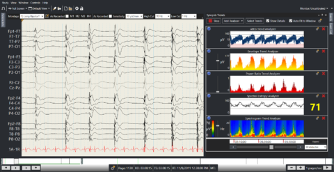 Arc EEG Software supports 32-288ch EEG, trends, and remote review