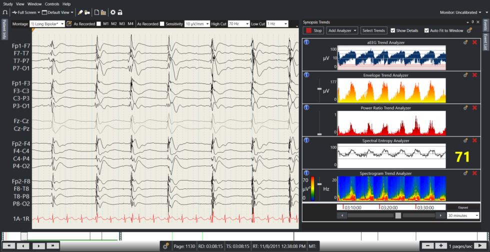 Arc EEG Software supports 32-288ch EEG, trends, and remote review