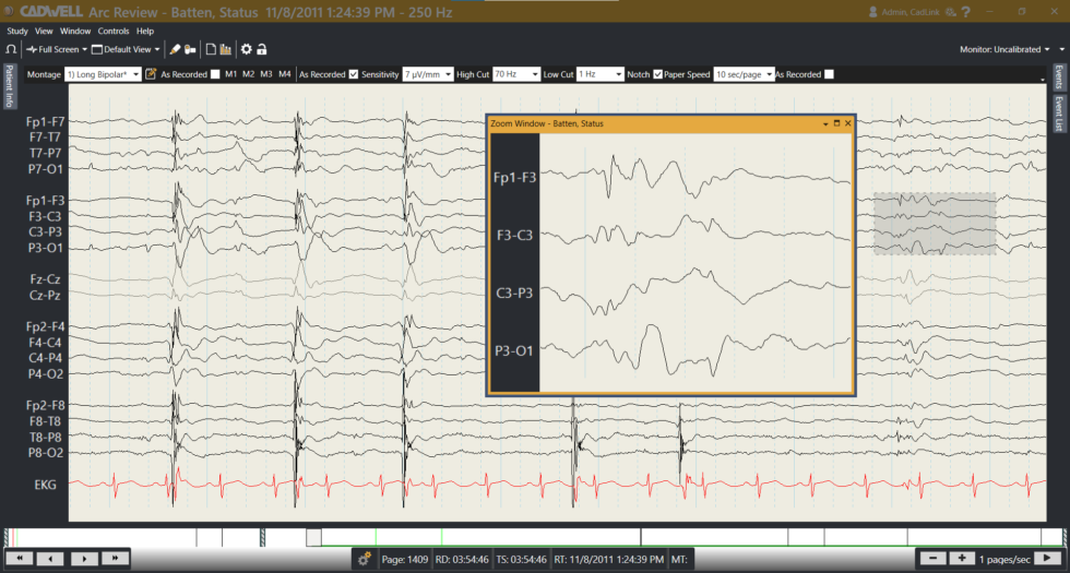 Arc EEG Software supports 32-288ch EEG, trends, and remote review