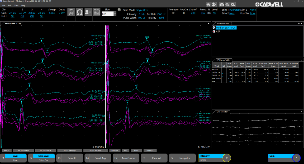 Sierra Software for dynamic Electrodiagnostic (EDX) Testing