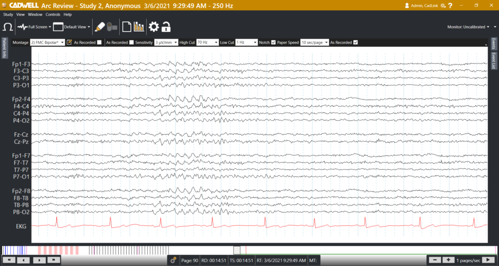 Arc EEG Software supports 32-288ch EEG, trends, and remote review