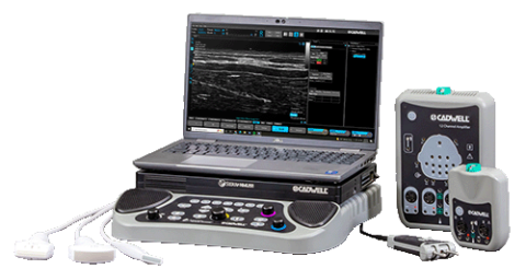 Sierra Software for dynamic Electrodiagnostic (EDX) Testing